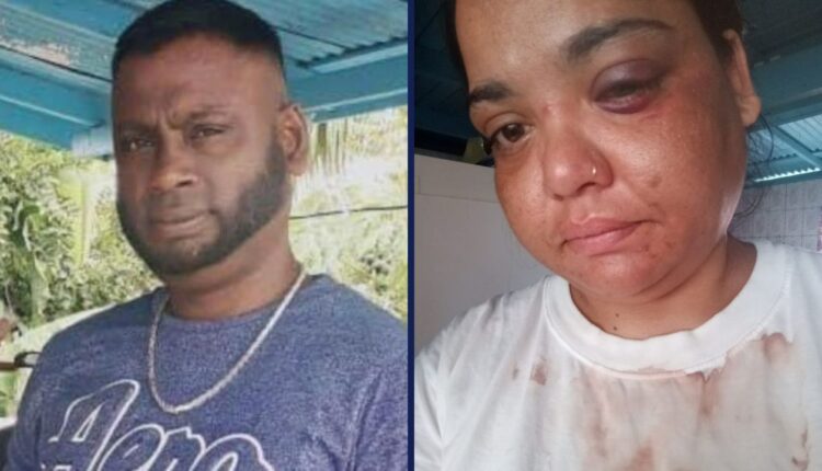 Berbice man wanted for attempted murder of ex-partner - News Room Guyana